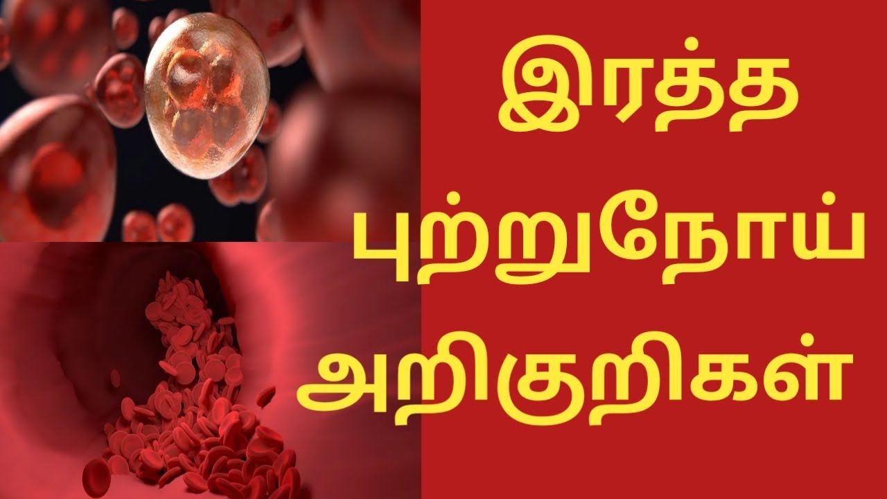Blood Cancer Symptoms In Tamil blood Cancer Signs In Tamil blood-cancer-symptoms-in-tamil-blood-cancer-signs-in-tamil