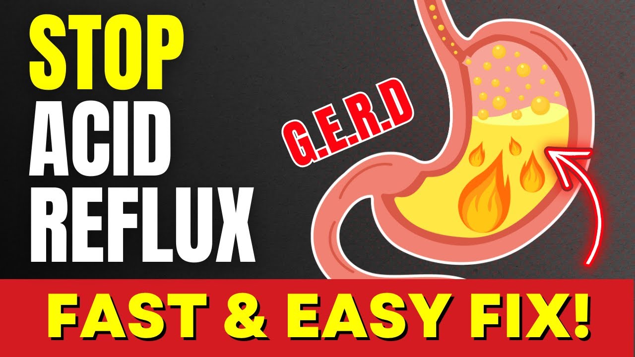 5 Natural Remedies for Acid Reflux Relief | Discover Effective ...
