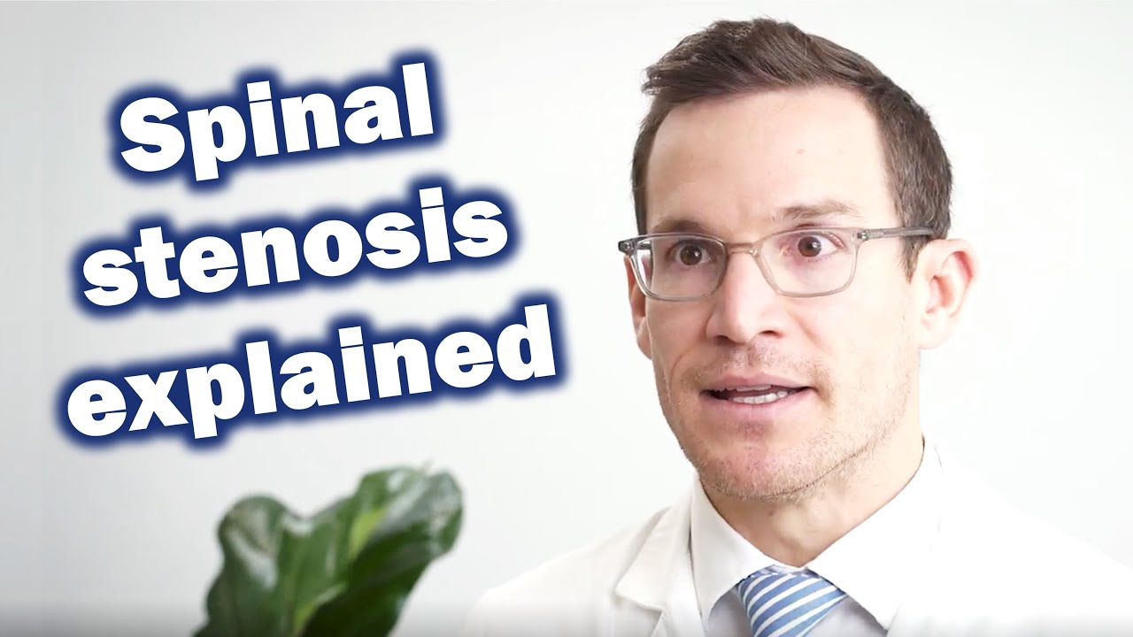 Spinal stenosis and its treatment explained by Dr. Peter Derman - YouTube