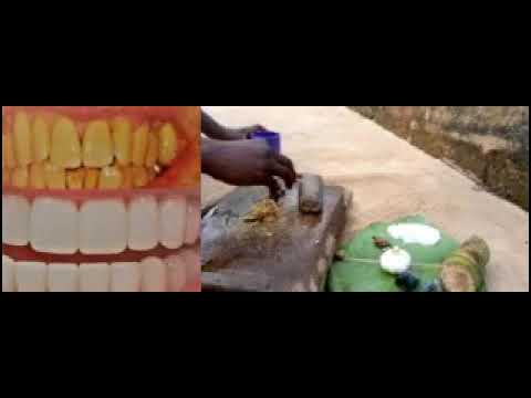 Primitive Teeth Whitening and Mouth Odour Removal in 30 Seconds ...