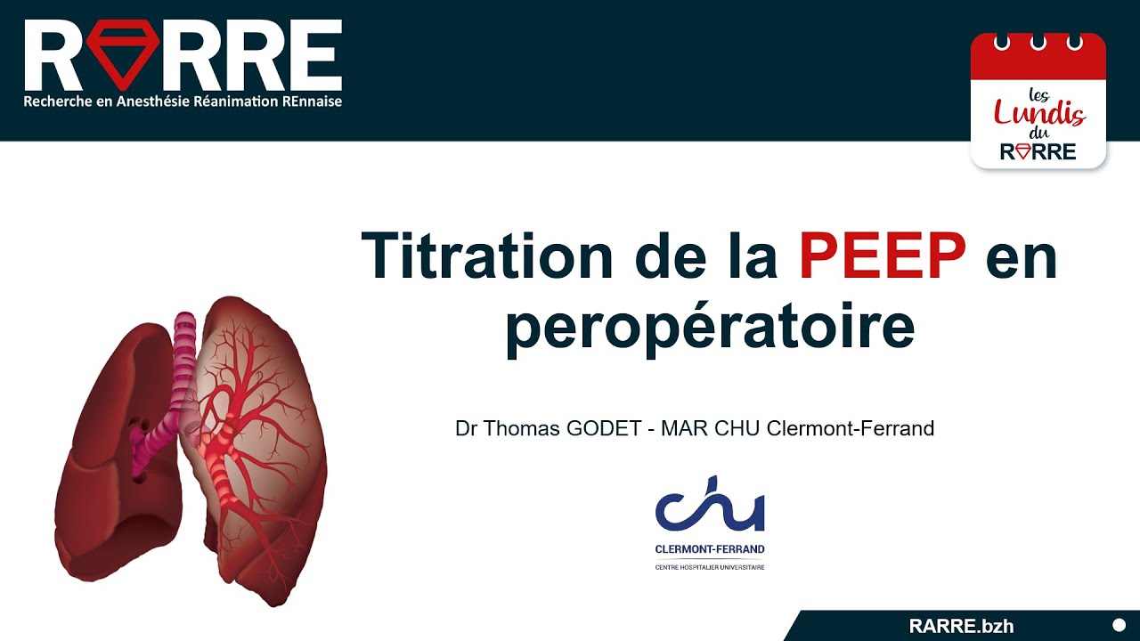 Lundi RARRE#19 Titration de la PEEP en peropératoire - YouTube