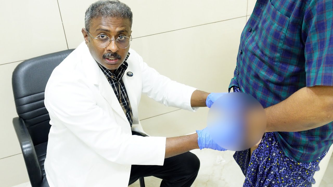 Tube Promedon Penile Implant | Real Results After Surgery - YouTube