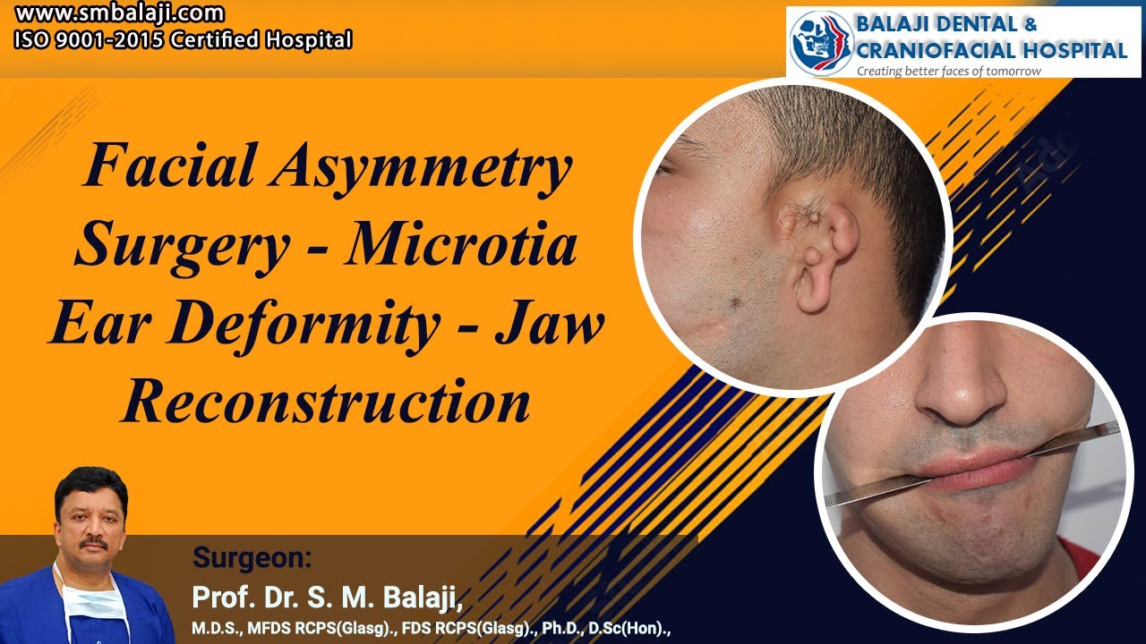 Facial Asymmetry Surgery Microtia Ear Deformity Jaw Reconstruction ...