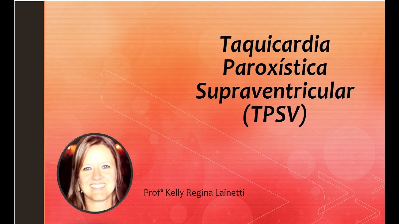 Taquicardia Paroxística Supraventricular (TPSV) - YouTube