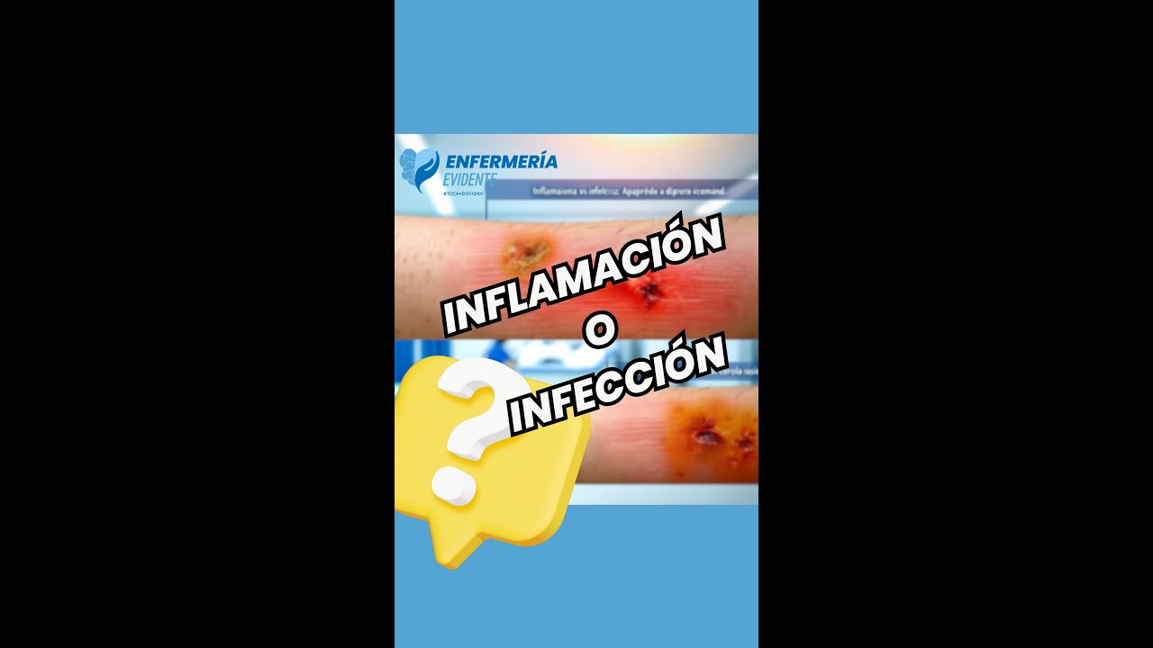 Los signos para diferenciar inflamación de infección en una herida ...