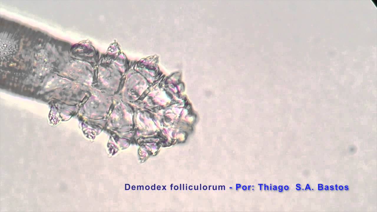 Demodex folliculorum (hominis) ♀ - YouTube