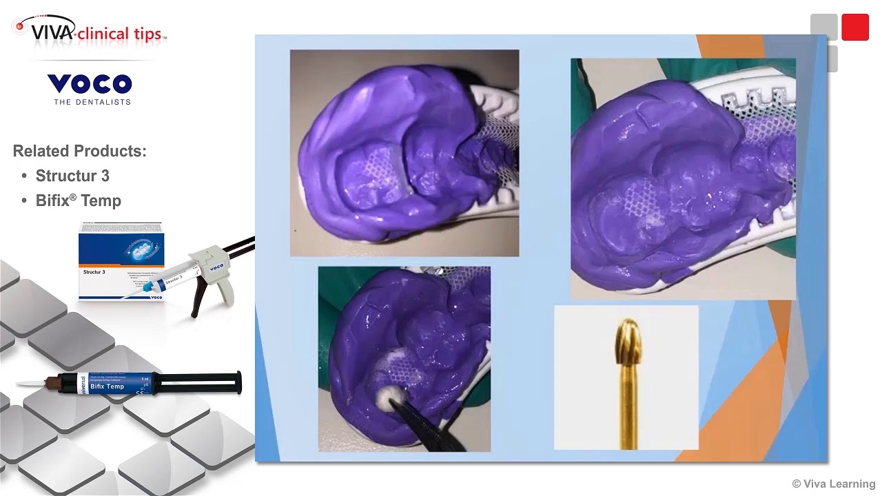 Dr. Lipscomb on Structur 3 and Bifix Temp - YouTube