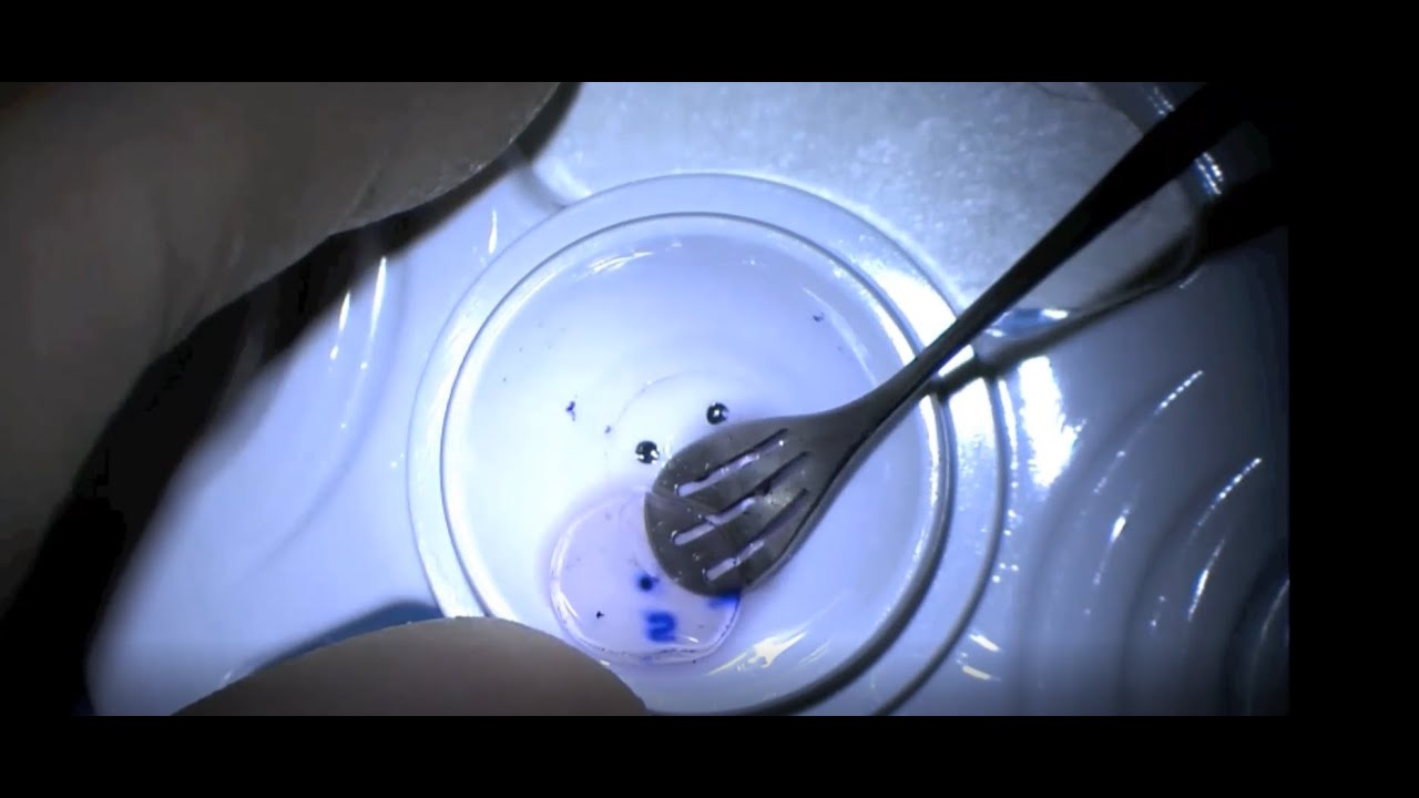 DSAEK featuring CORONET Donor Punch & EndoGlide Ultrathin - YouTube