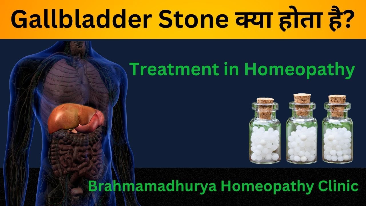 Gallbladder Stone क्या होता है? - पित्ताशय की पथरी का समाधान ...