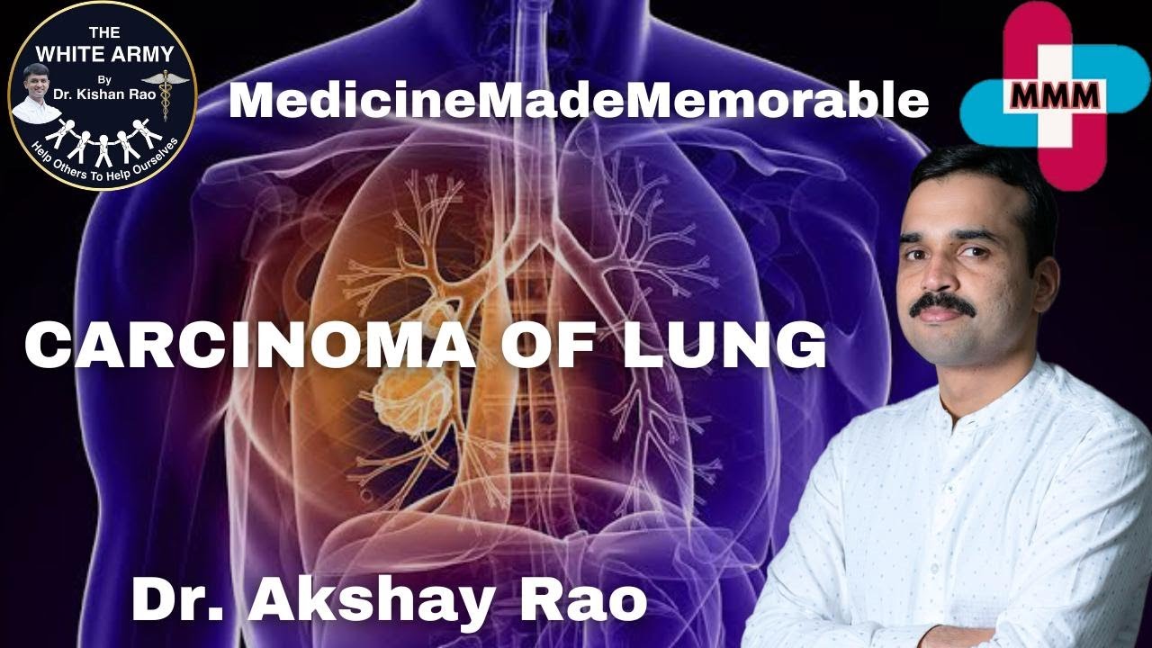 MMM 5 - Carcinoma of Lung | Dr Akshay Rao - YouTube
