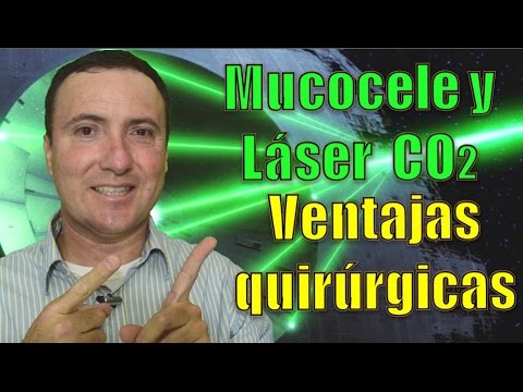 Mucocele y Láser CO2: ventajas quirúrgicas. - YouTube