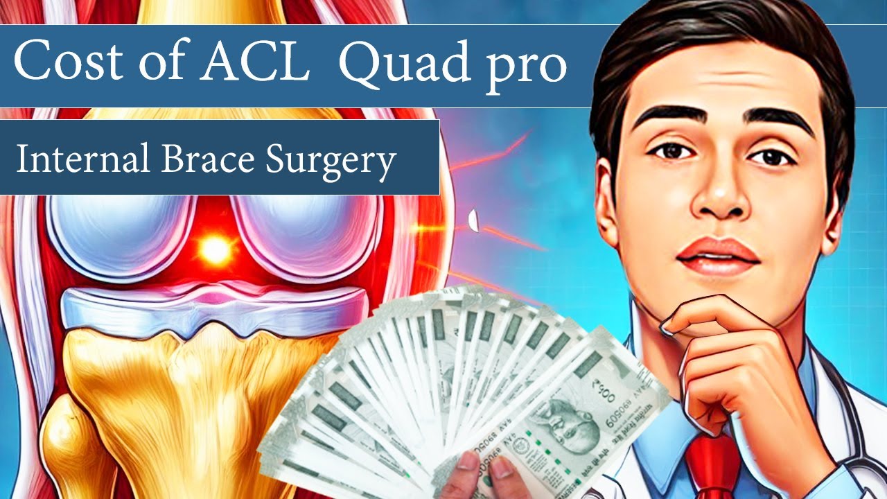 Cost of ACL Quad pro Internal Brace Surgery #acltreatment #acl - YouTube