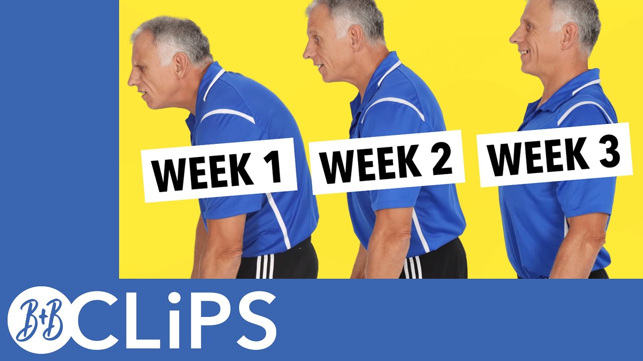 How To Stop Walking Hunched Over! 5 Best Fixes (B&B Clips) - YouTube
