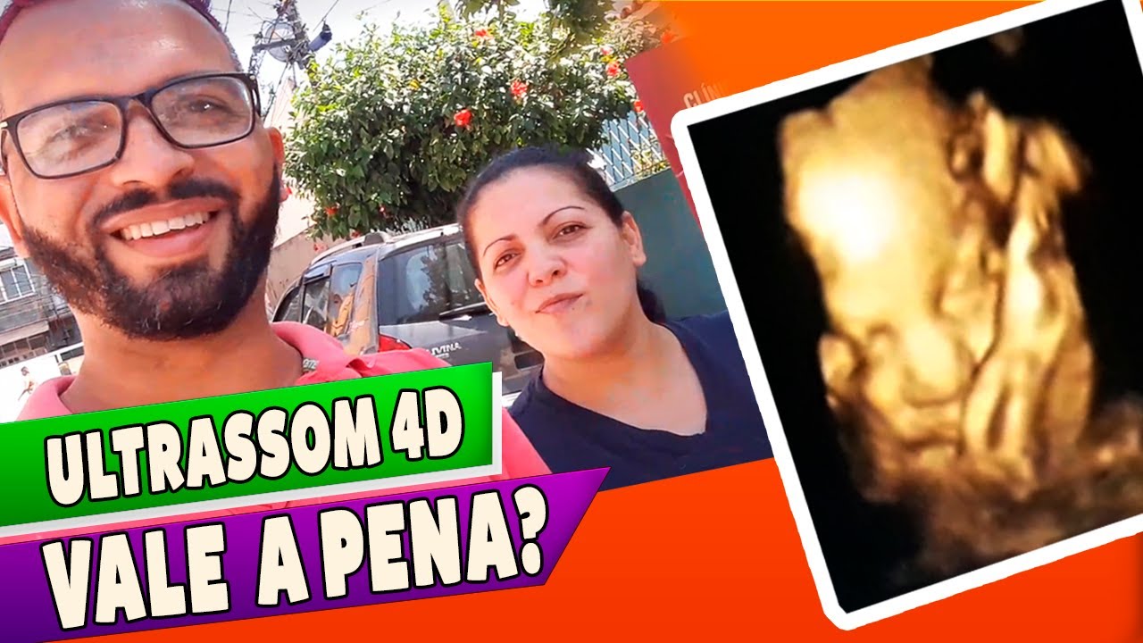 Ultrassom 4D da Kaylla 33 Semanas de Gestação - É EMOCIONANTE - YouTube