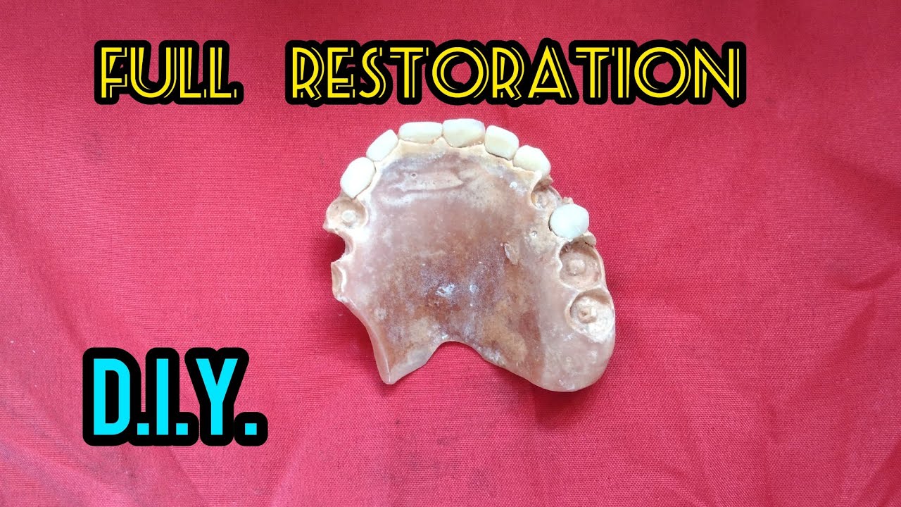 DENTURE FULL RESTORATION | WAG AGAD ITAPON ANG POSTISO, PWEDE PA PALA ...
