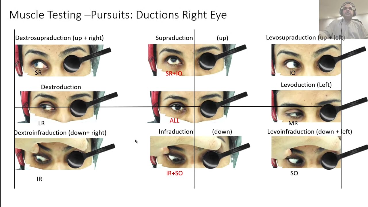 Extraocular Movements Clinical Skills in Ophthalmology - YouTube