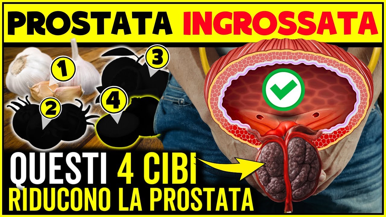 Questi 4 Cibi Riducono La Prostata Ingrossata | Ipertrofia Prostatica ...