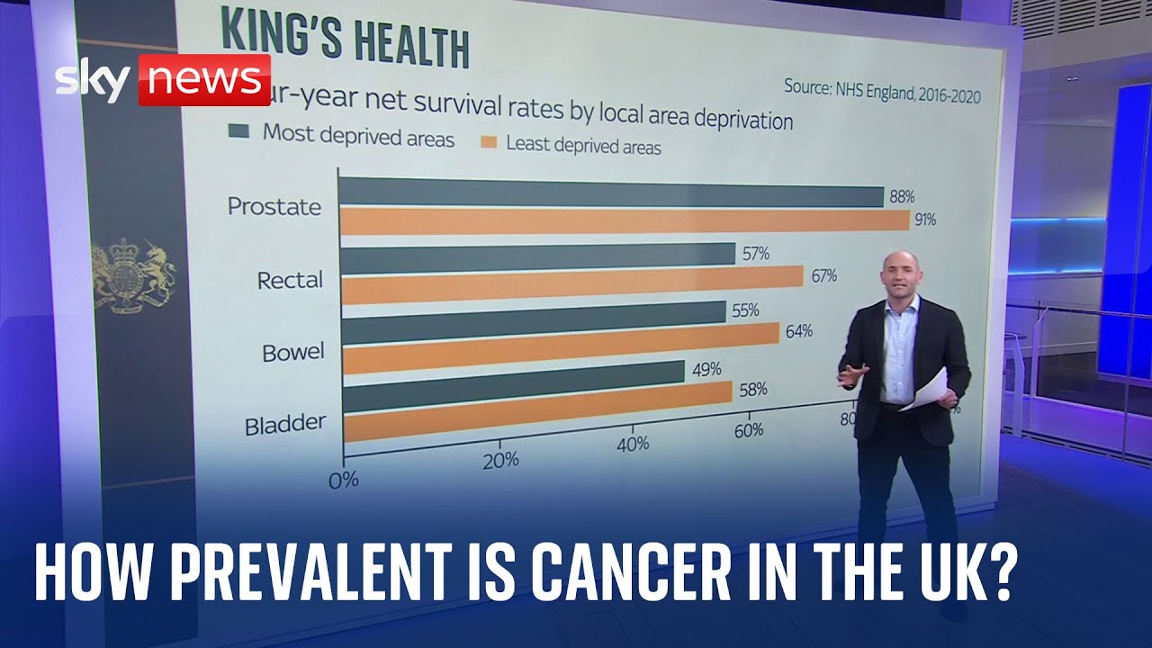 How prevalent is cancer in the UK, and what are the most common types ...