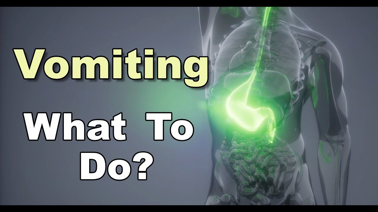 Throwing Up? What to do? Get rid of Nausea and Vomiting. When You ...