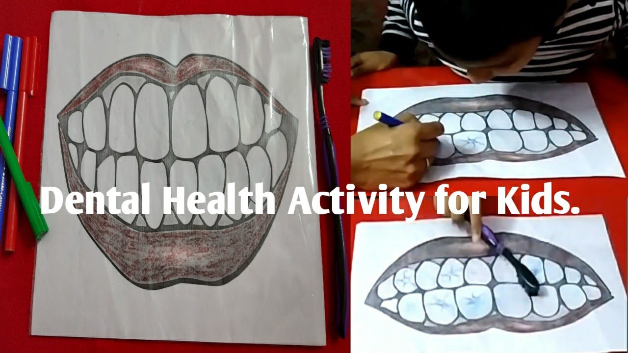 Teach Kids About Brushing Their Teeth | Dental Care Activity for ...