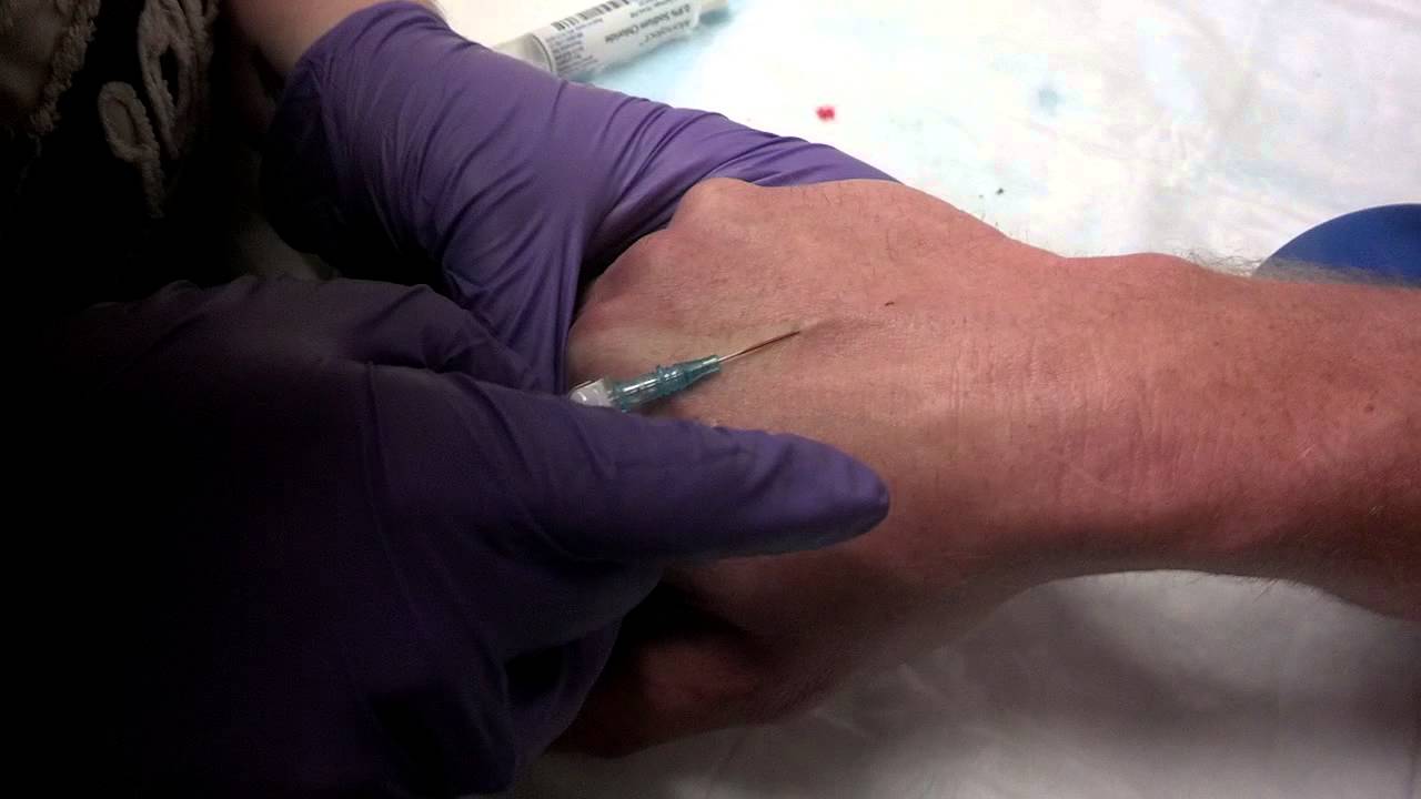Intravenous Access Training - YouTube