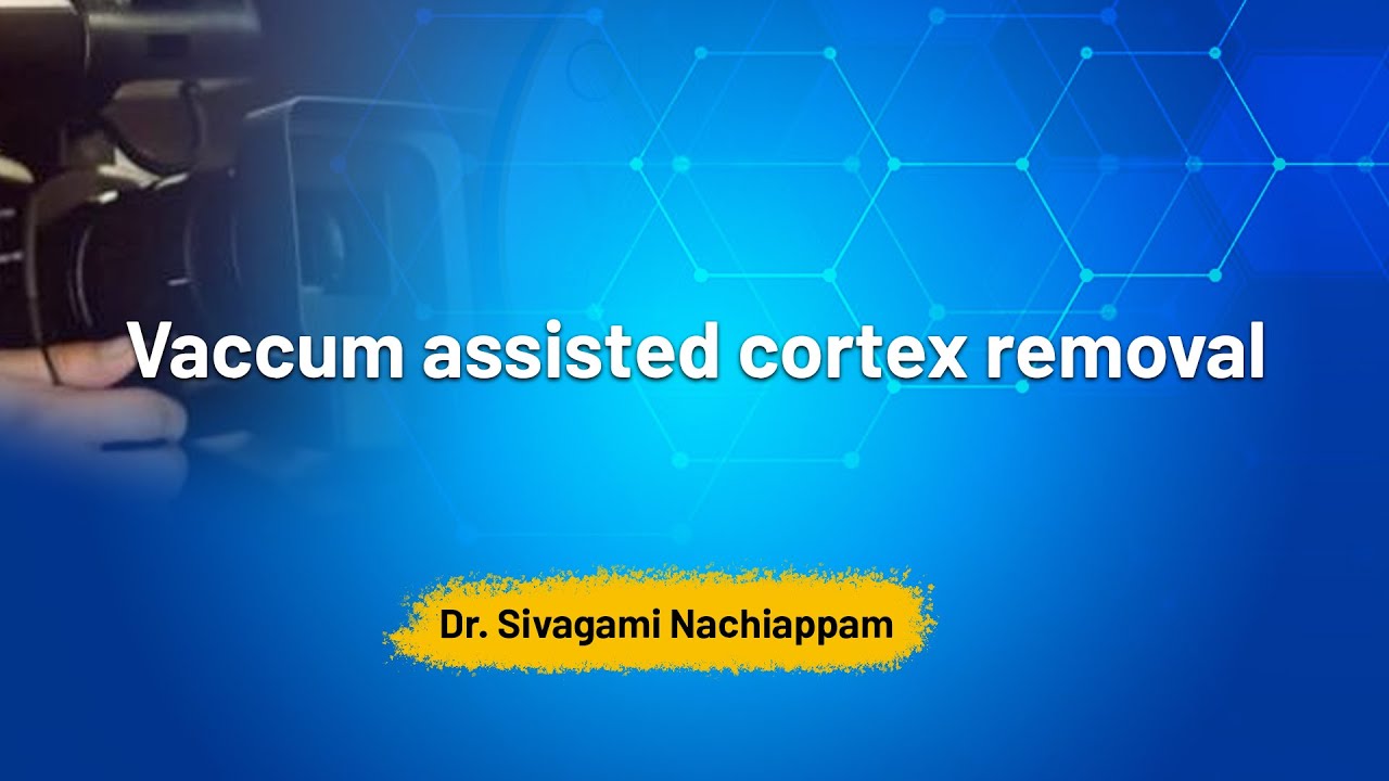 Videography Competition : Vaccum assisted cortex removal - Dr. Sivagami ...
