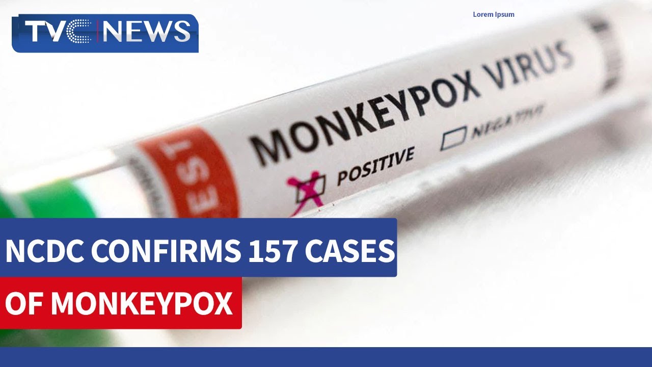 (ANALYSIS) Monkeypox: NCDC Confirms 157 Cases In Nigeria - YouTube