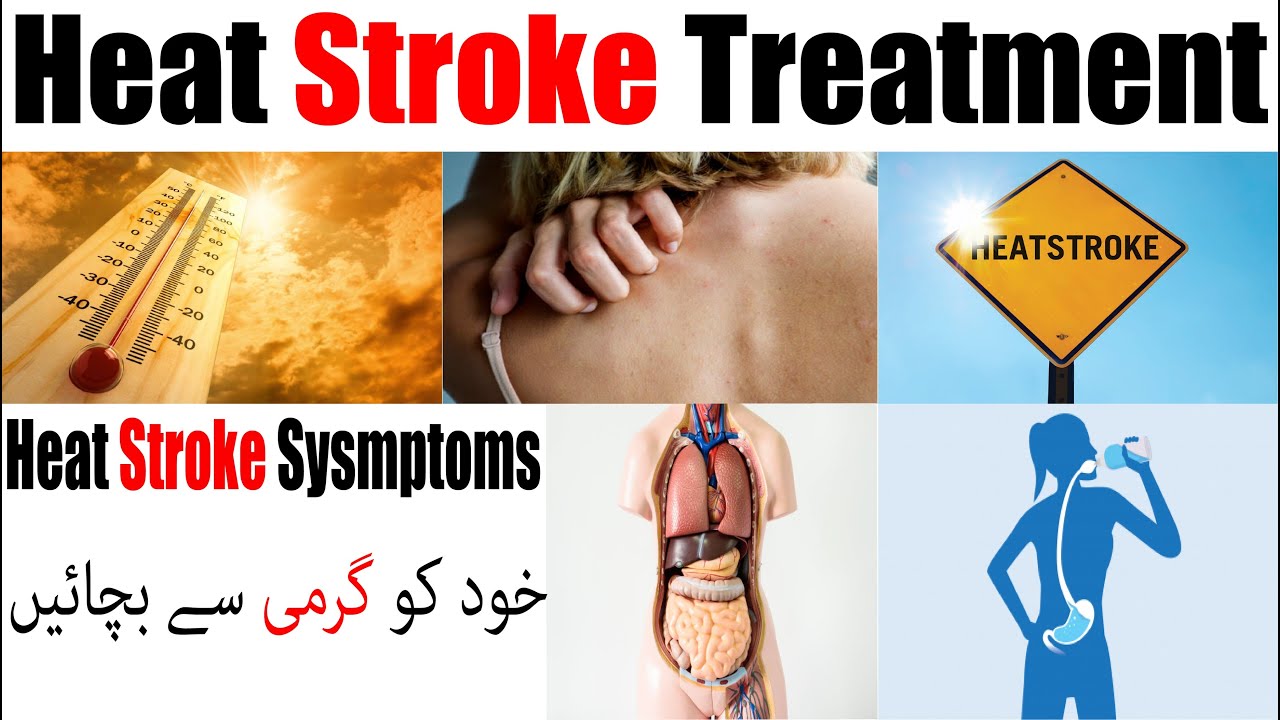 Heat Stroke Treatment L Heat Stroke Symptoms L Heat Stroke In Urdu heat-stroke-treatment-l-heat-stroke-symptoms-l-heat-stroke-in-urdu