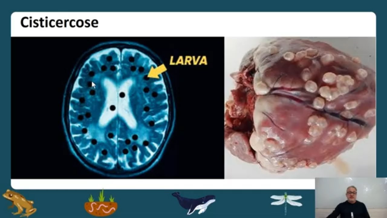 CISTICERCOSE: CICLO BIOLOGICO, SINTOMAS, PREVENÇÃO E TRATAMENTO - YouTube