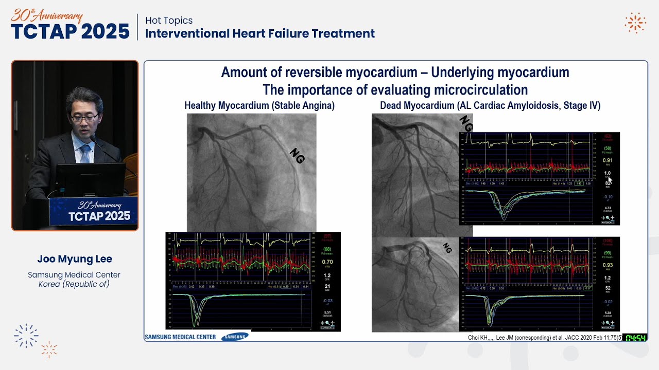 [TCTAP 2025] Hot Topics - Interventional Heart Failure Treatment - YouTube