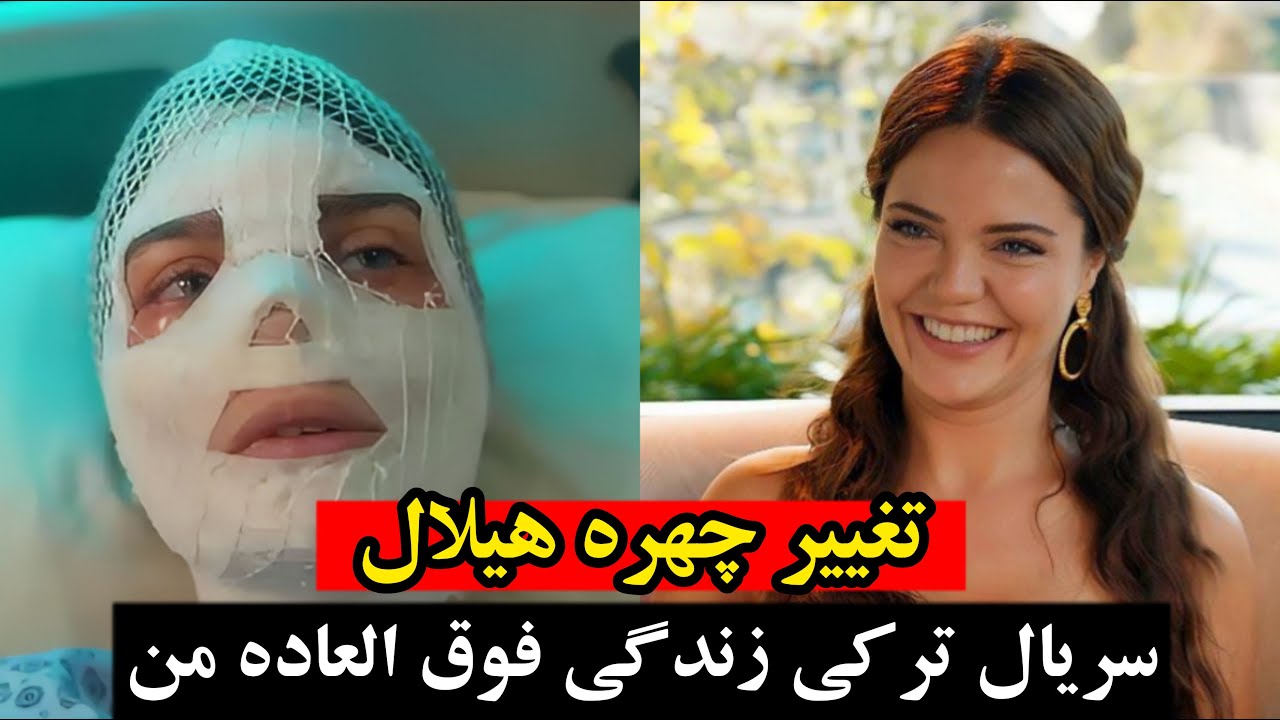 سریال ترکی زندگی فوق العاده من،تغییر چهره هیلال آلتینبیلک در سریال ترکی زندگی فوق العاده من
