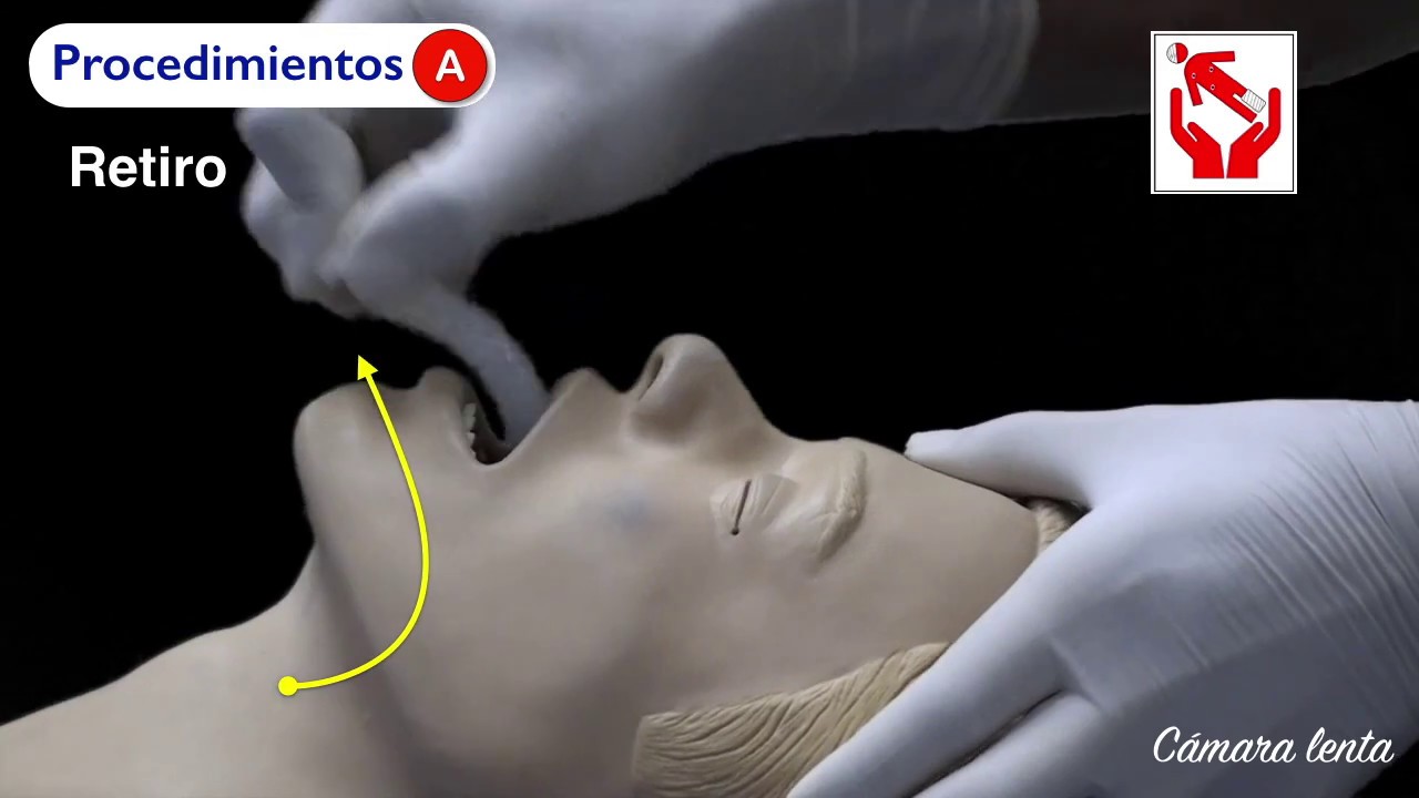 V1 Cánula Orofaringea - YouTube