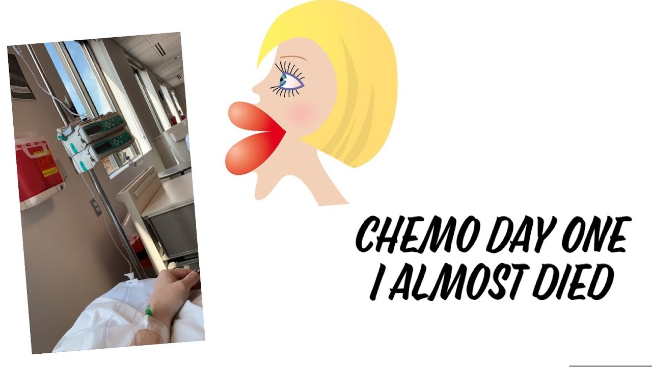 Chemo day one: I almost died/ Chemo reaction and my first dose update ...