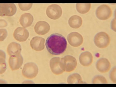 Blood 3, Blood cells. - YouTube