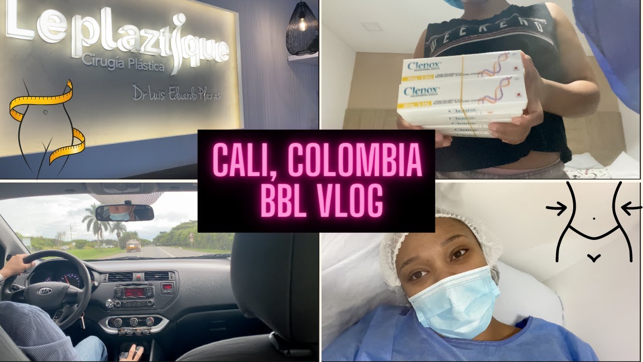 BBL Vlog | BBL Journey | Dr. Plazas | Cali, Colombia | I Finally Did It ...