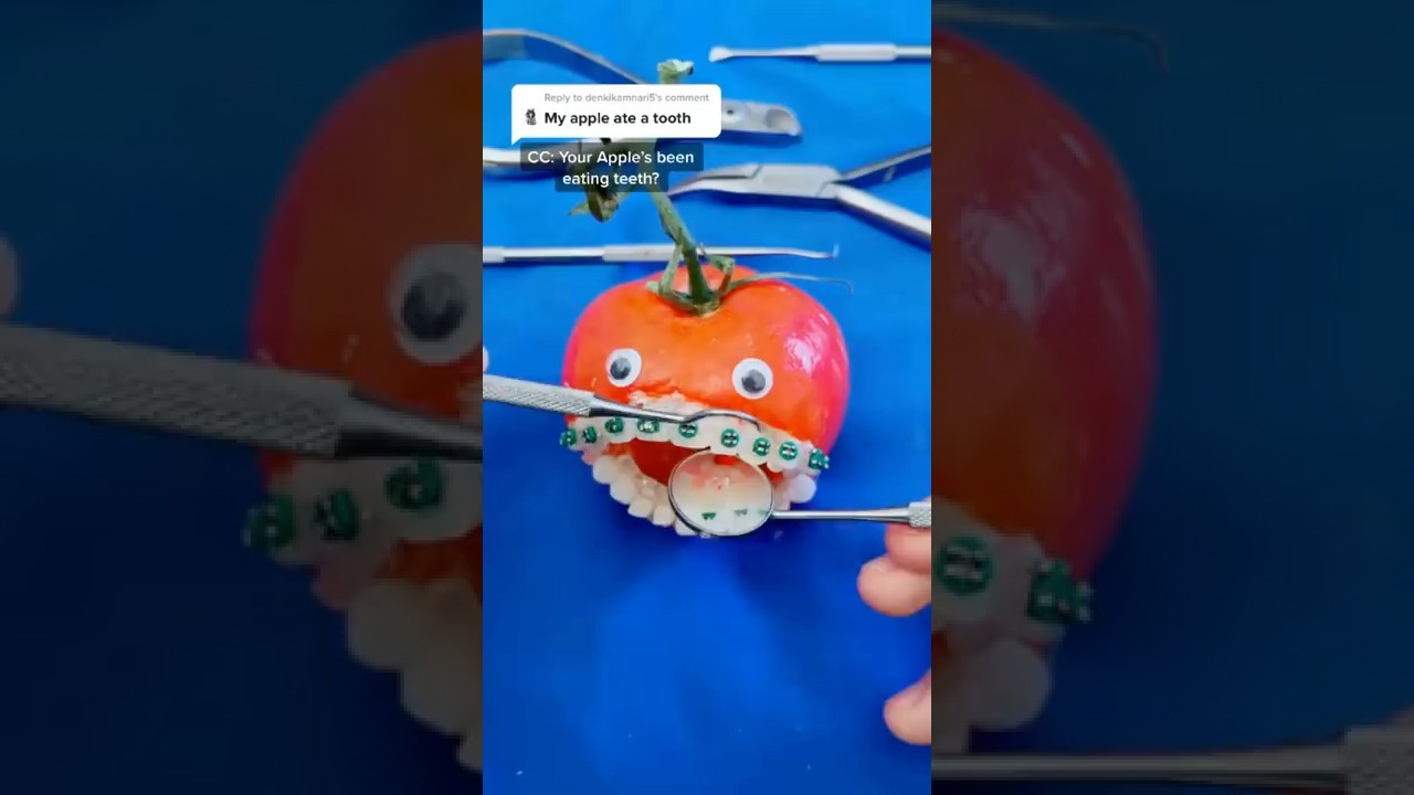 First Fruit Surgey ever by the Discount Dentist! Ep 36 by Fleeting ...