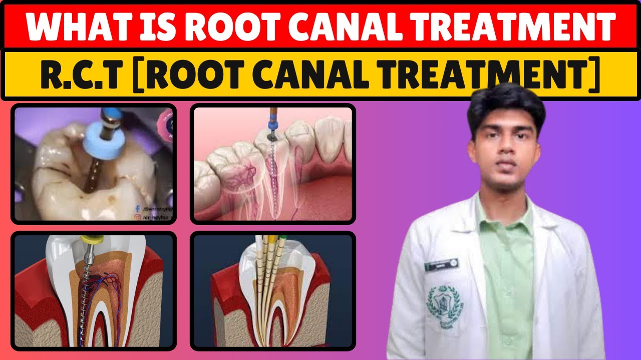 What is RCT [Root Canal Treatment] - YouTube