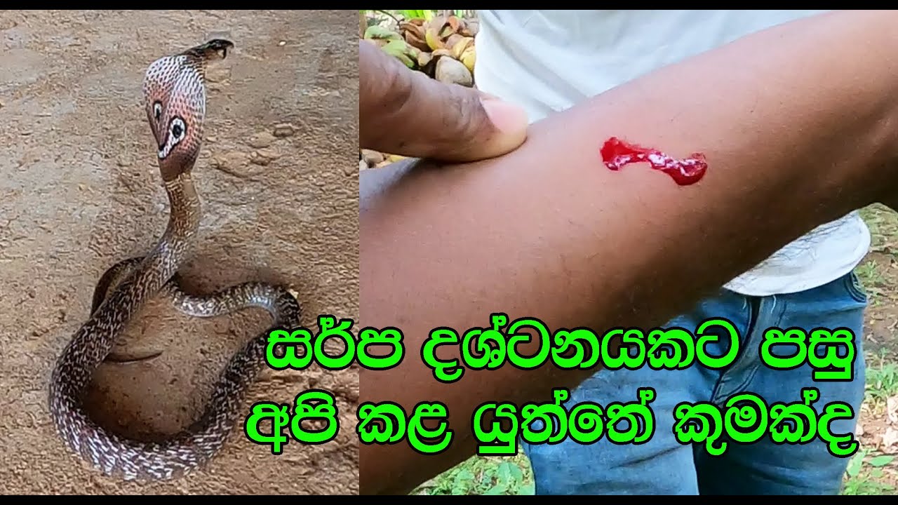 What to do after a snake bite - YouTube