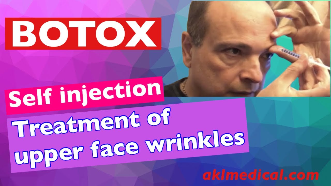 BOTOX self injection. Do not try on your own - YouTube