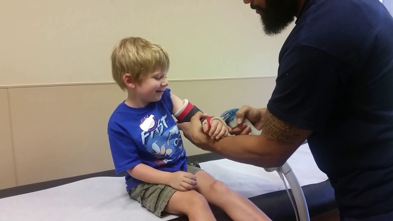 Cast Removal - YouTube