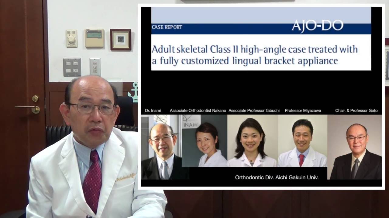 Adult skeletal Class II high-angle case treated with a fully customized ...