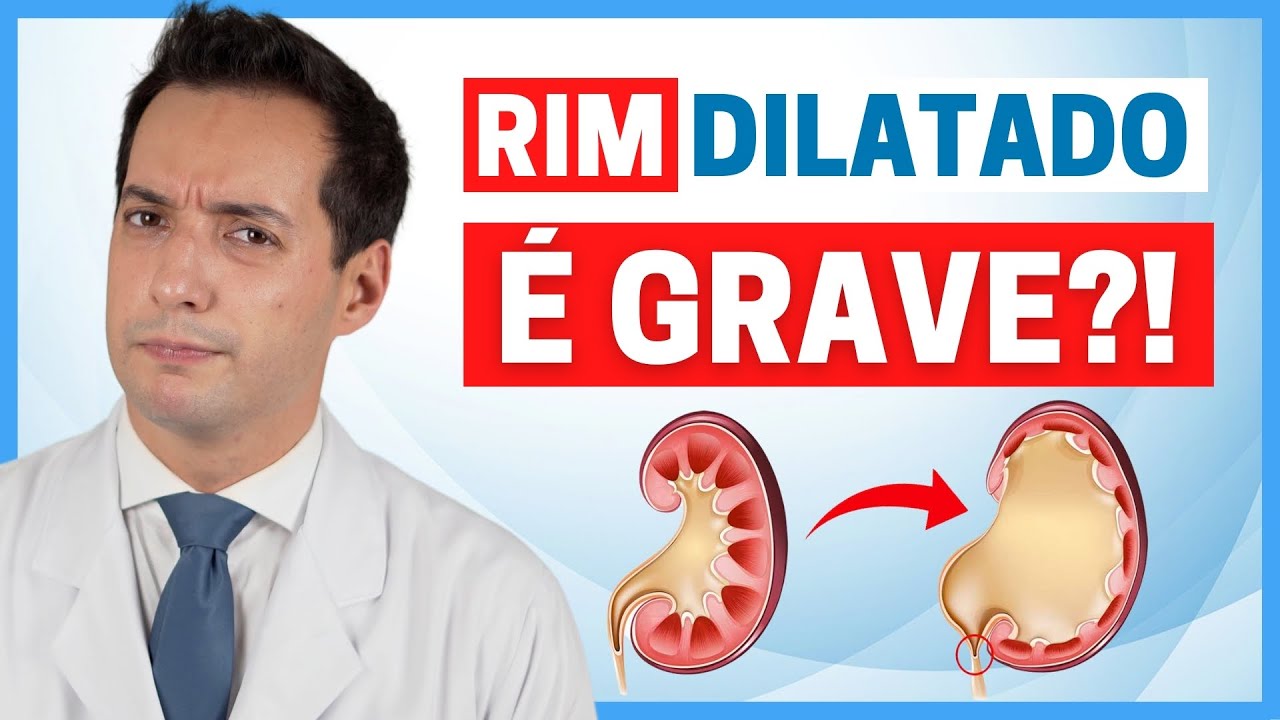 RIM DILATADO É GRAVE? CONHEÇA AS CINCO PRINCIPAIS CAUSAS E COMO TRATAR ...