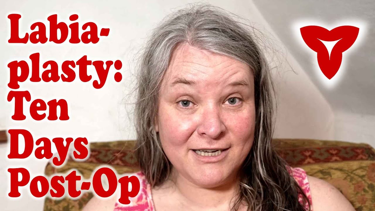 Labiaplasty Stitches