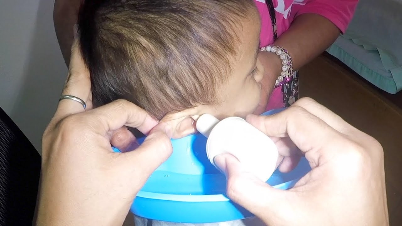 Removing Something (Foreign Object )Stuck in Boy's Ear | What is It ...