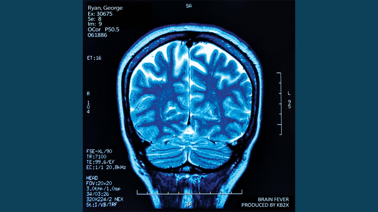Brain Fever - YouTube