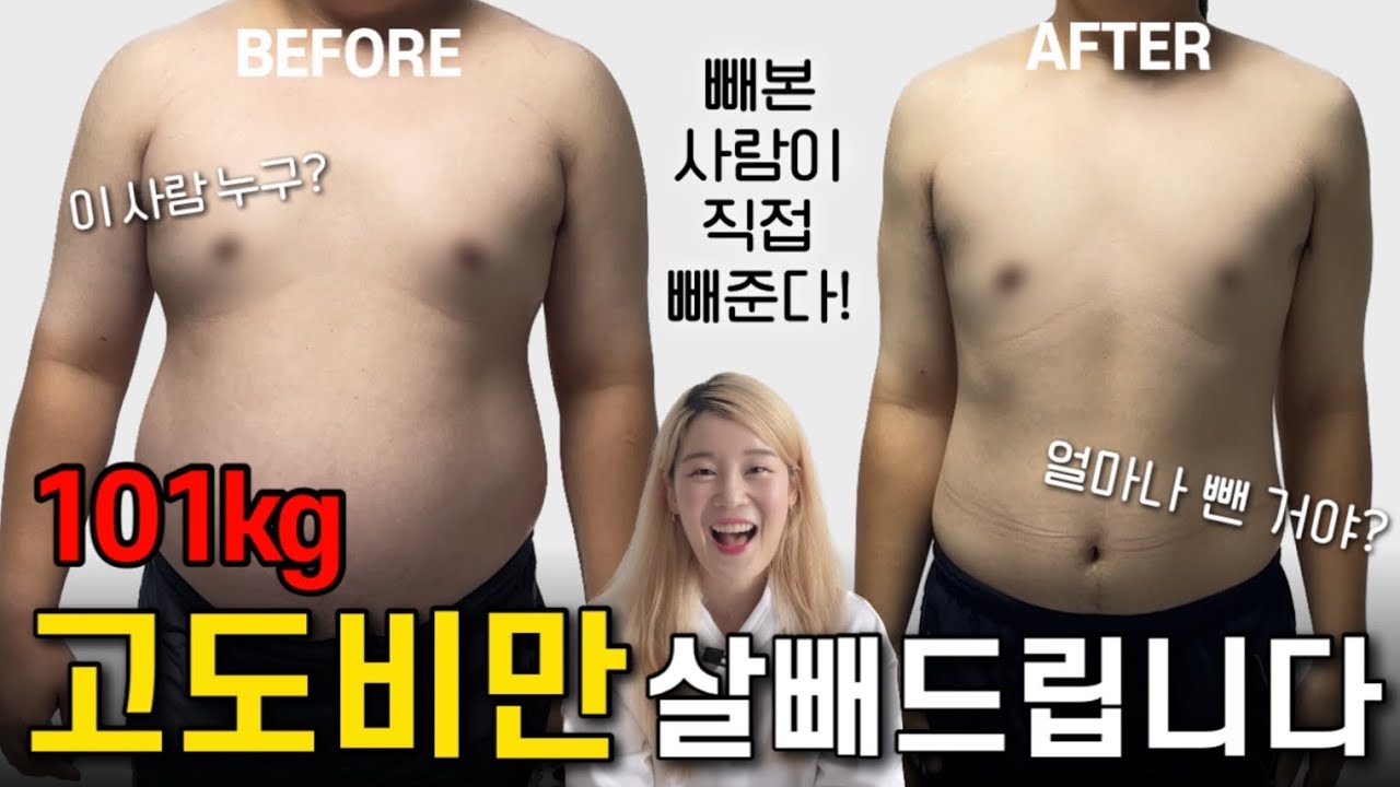 101kg 고도비만 살 빼줬어요🔥 나도 고도비만에서 시작했거든😎 #고도비만 #고도비만다이어트 #다이어트 - YouTube