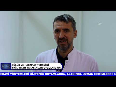 SÜLÜK VE HACAMAT TEDAVİSİ EHİL ELLER TARAFINDAN UYGULANIYOR