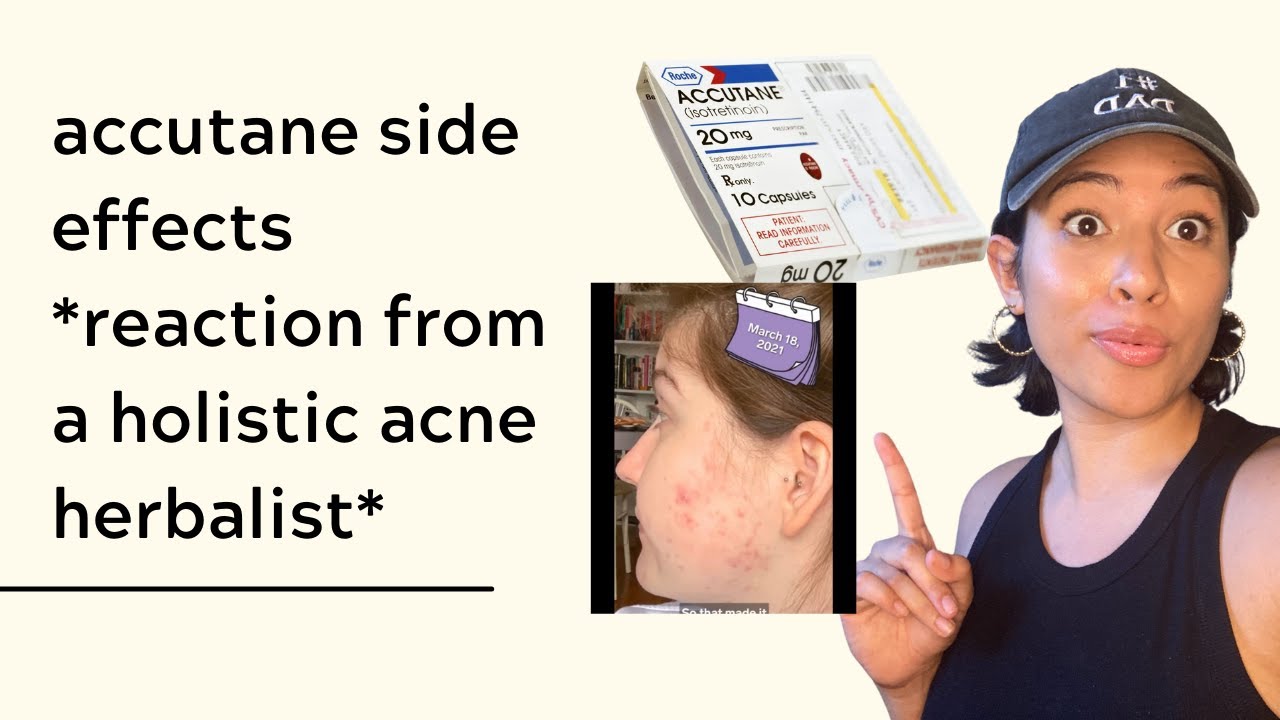 accutane side effects 😲 *holistic acne herbalist reaction video* - YouTube