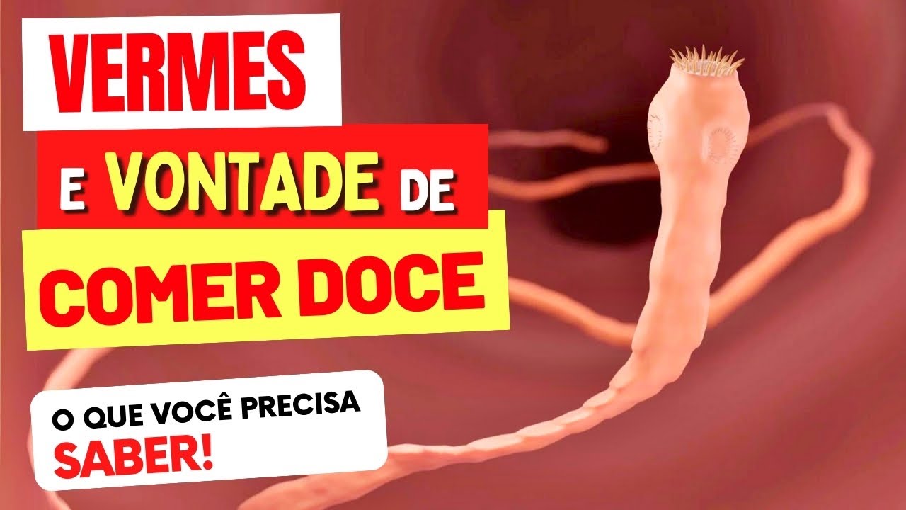 VERMES e VONTADE DE COMER DOCE - O que você PRECISA SABER! - YouTube