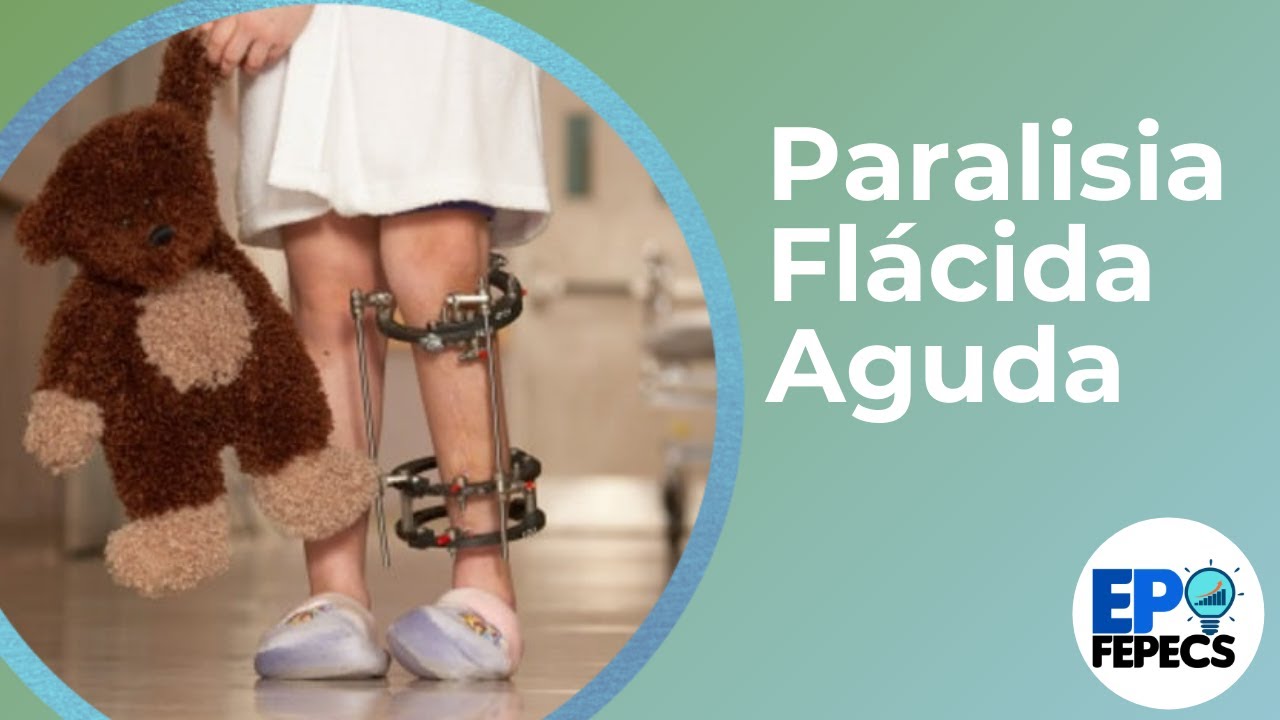 Paralisia Flácida Aguda - YouTube
